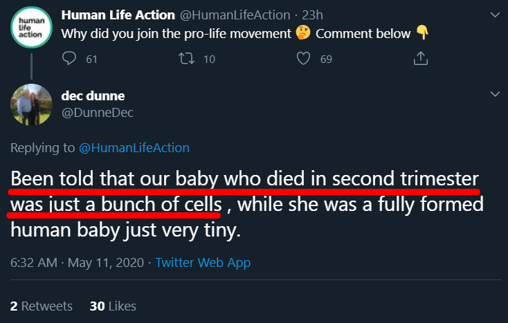 Many pro-choice views depend on believing embryos are "clumps of cells ...
