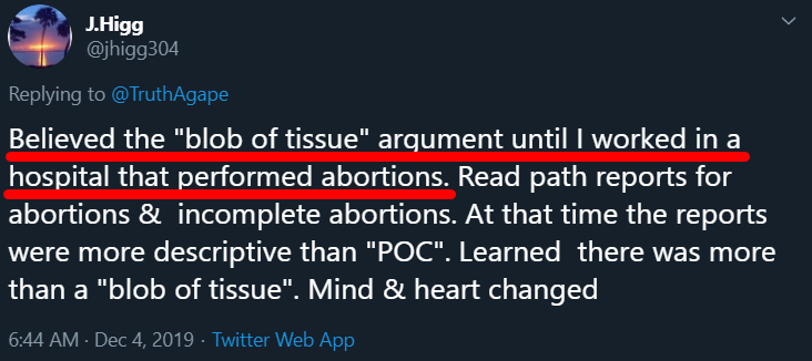 Many pro-choice views depend on believing embryos are "clumps of cells ...